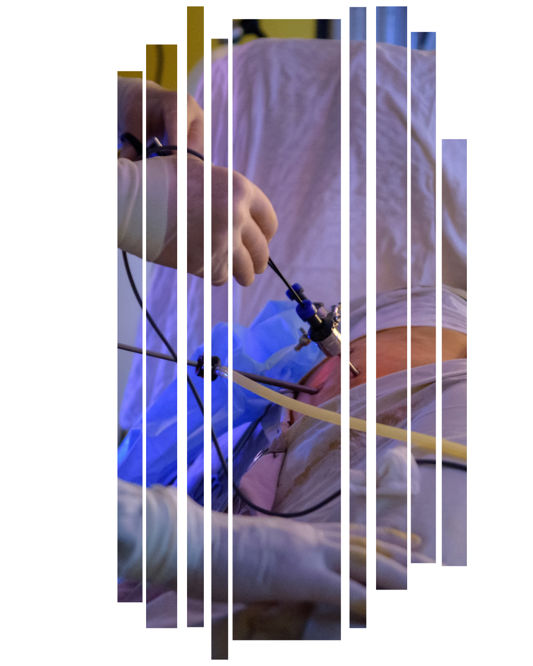 Laparoscopic Surgery - Vedansh Medicare